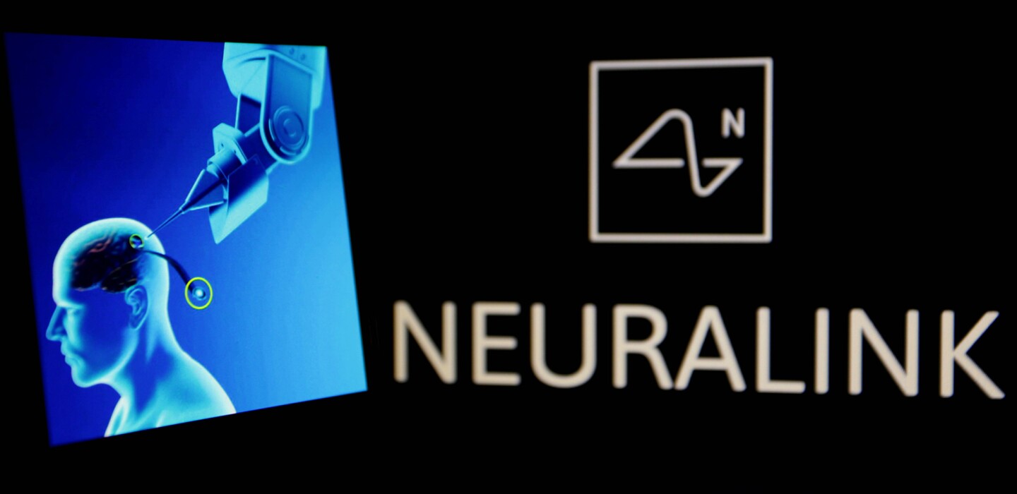 Neuralink, la société d’implants cérébraux d’Elon Musk, vise une réalité à la «Matrix» - l'Opinion